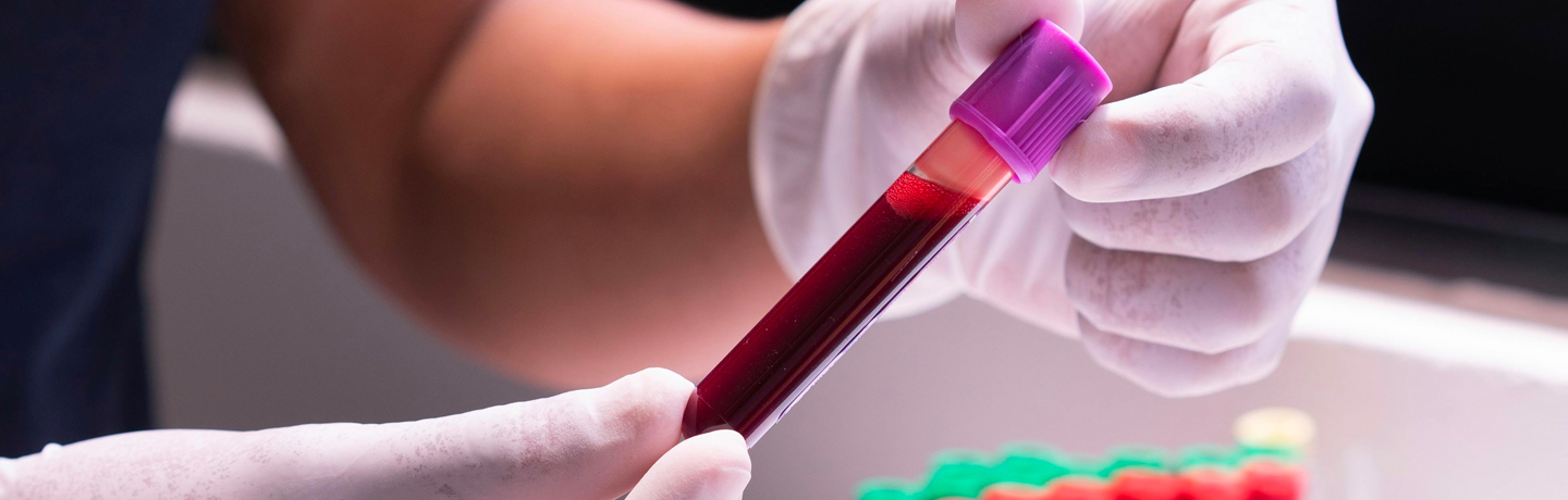 Blood Test: A Powerful Monitor Of Health - TheThriver